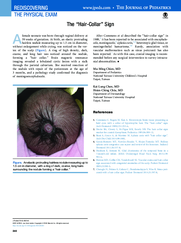 (PDF) The “Hair-Collar” Sign