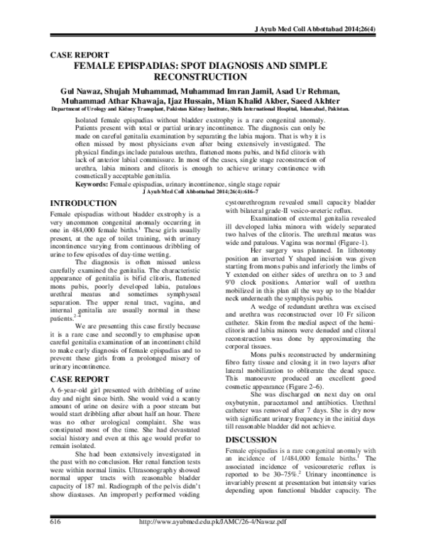 (PDF) Female epispadias: spot diagnosis and simple reconstruction