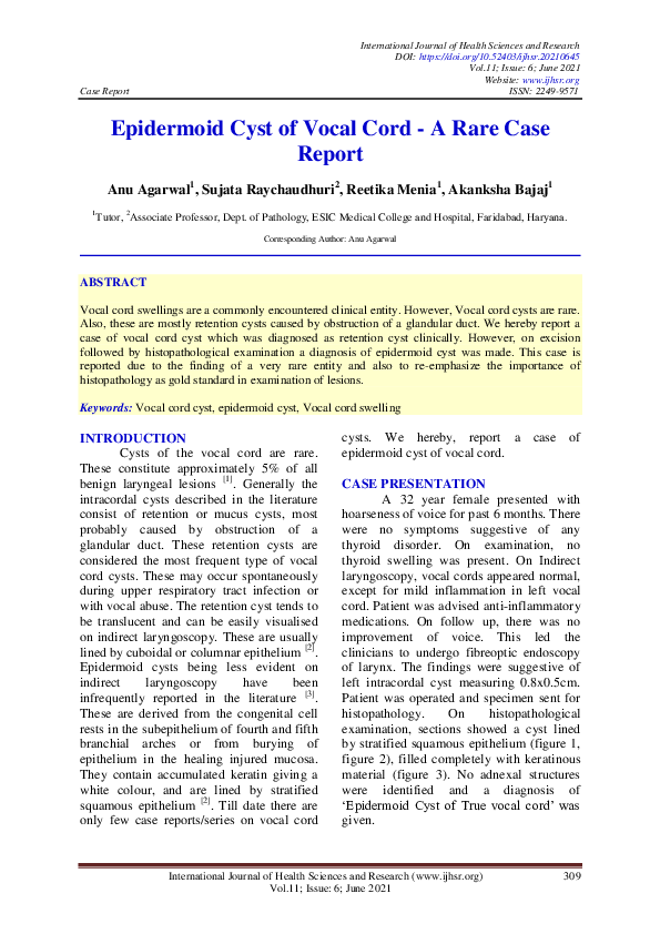 Pdf Epidermoid Cyst Of Vocal Cord A Rare Case Report 1652