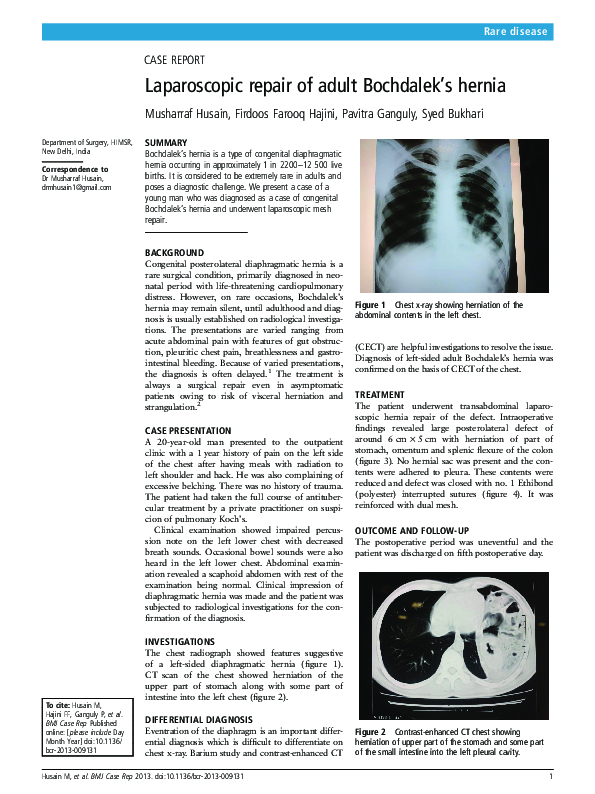 (PDF) Laparoscopic repair of adult Bochdalek's hernia | Musharraf ...