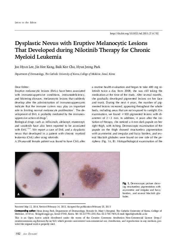 (PDF) Dysplastic Nevus with Eruptive Melanocytic Lesions That Developed ...
