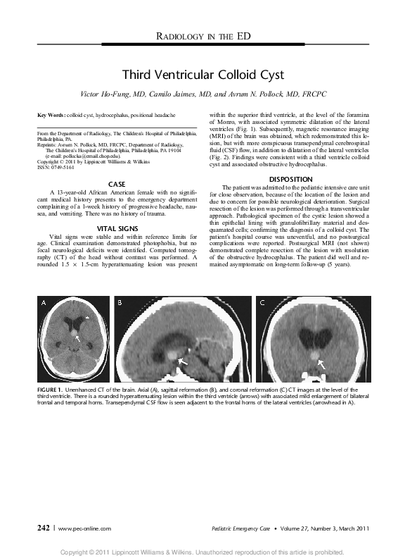 Pdf Third Ventricular Colloid Cyst Camilo Figueroa Jaimes