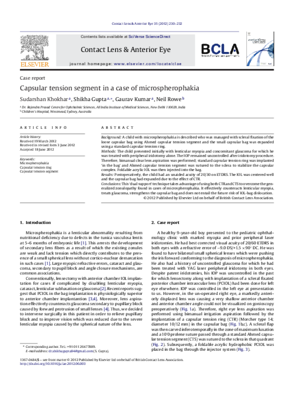 (PDF) Capsular tension segment in a case of microspherophakia