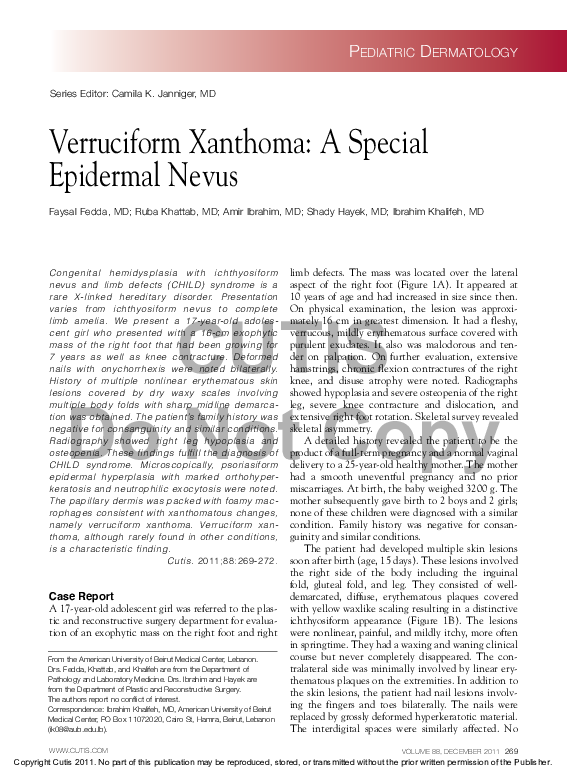 (PDF) Verruciform xanthoma: a special epidermal nevus