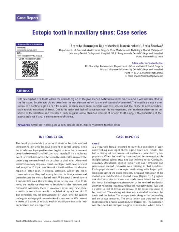 (PDF) Ectopic tooth in maxillary sinus: Case series