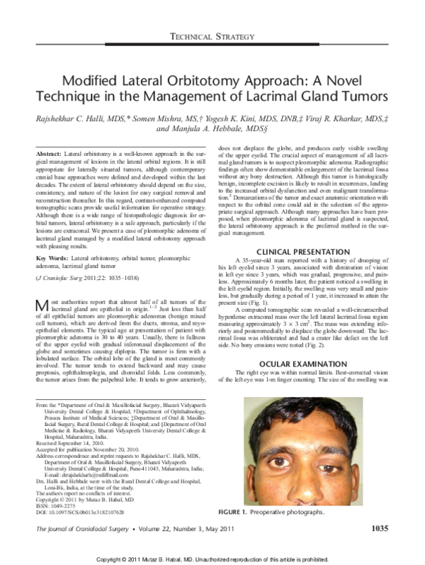 (PDF) Modified Lateral Orbitotomy Approach