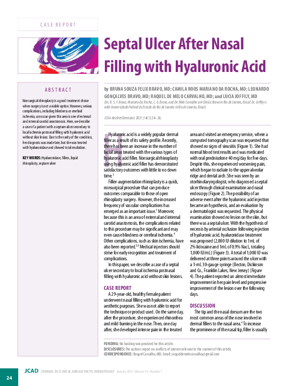 (PDF) Septal Ulcer After Nasal Filling with Hyaluronic Acid