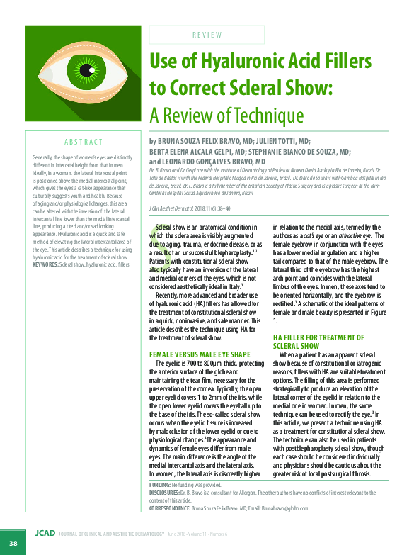 (PDF) Use of Hyaluronic Acid Fillers to Correct Scleral Show: A Review ...