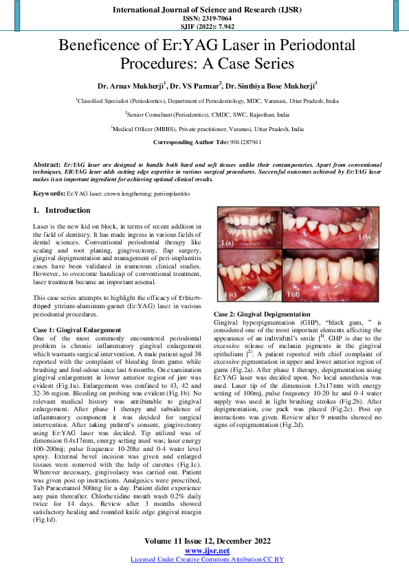 (PDF) Beneficence of Er:YAG Laser in Periodontal Procedures: A Case Series