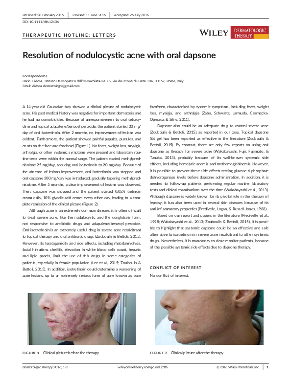 (PDF) Resolution of nodulocystic acne with oral dapsone