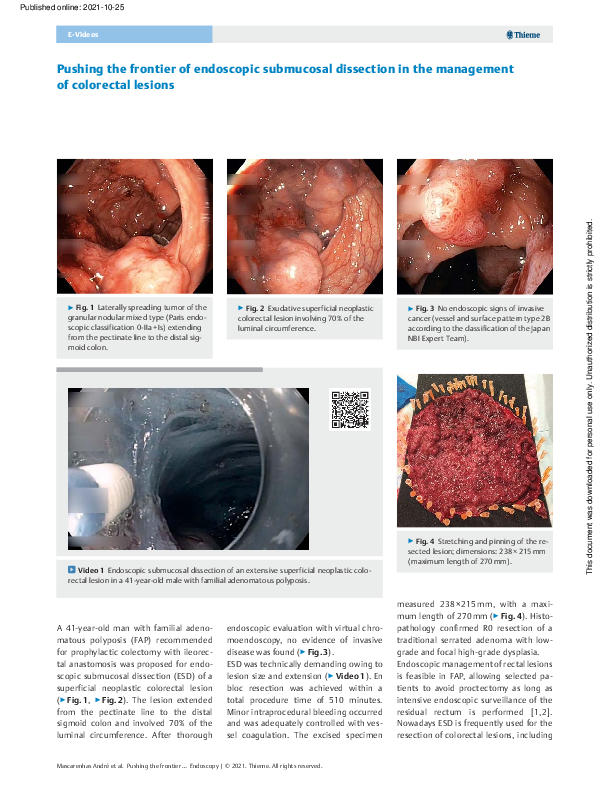 (PDF) Pushing the frontier of endoscopic submucosal dissection in the ...
