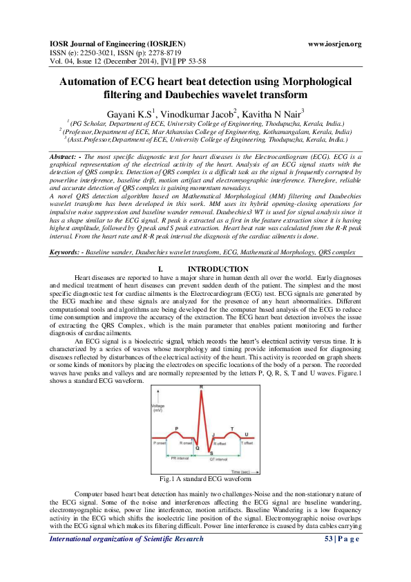 (PDF) Automation of ECG heart beat detection using Morphological ...
