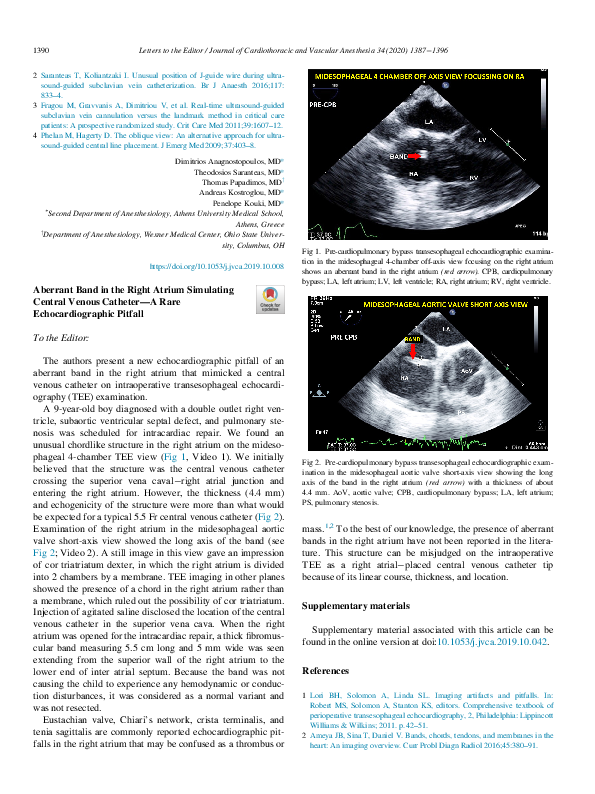 (PDF) Aberrant band in the right atrium simulating central venous ...