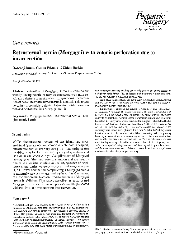 (PDF) Retrosternal hernia (Morgagni) with colonic perforation due to ...