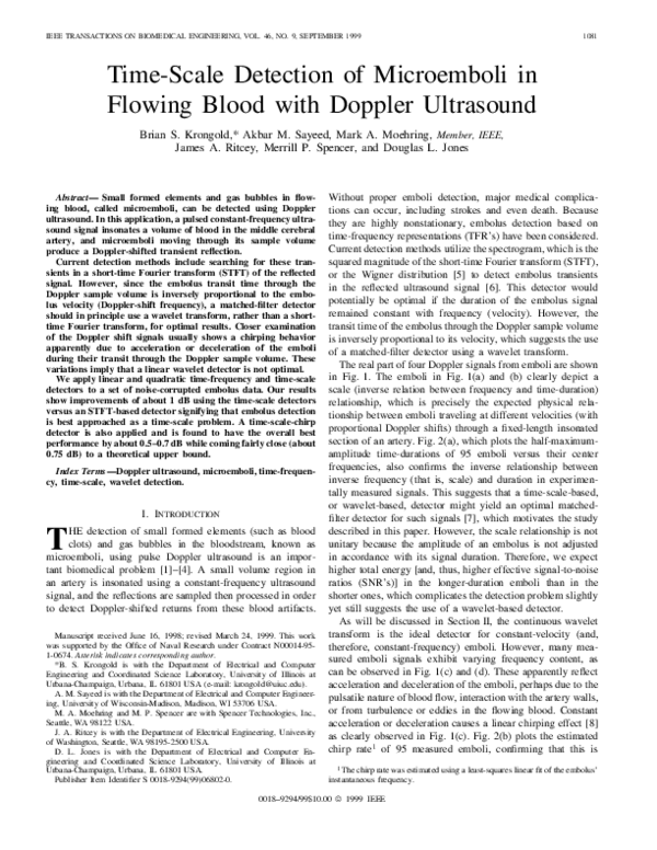 (PDF) Time-scale detection of microemboli in flowing blood with Doppler ...