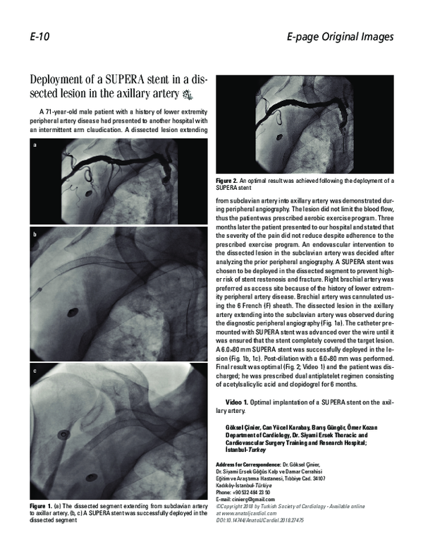 (PDF) Deployment of a SUPERA stent in a dissected lesion in the ...