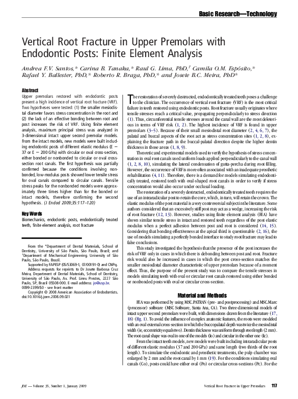 (PDF) Vertical root fracture in upper premolars with endodontic posts ...