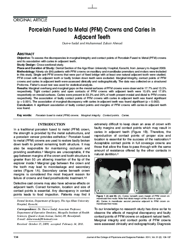 (PDF) Porcelain fused to metal (PFM) crowns and caries in adjacent teeth