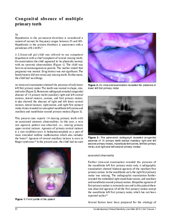 (PDF) Congenital absence of multiple primary teeth