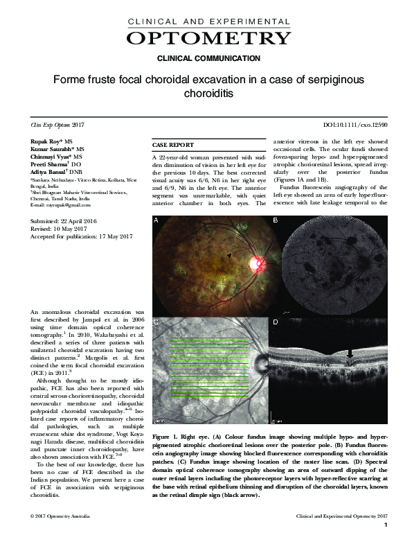 (PDF) Forme fruste focal choroidal excavation in a case of serpiginous ...