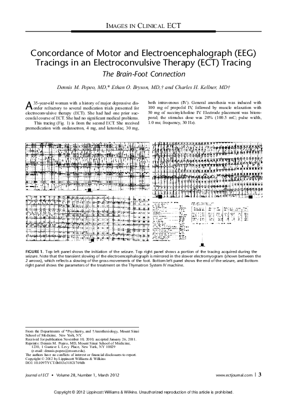 (PDF) Concordance of Motor and Electroencephalograph (EEG) Tracings in ...