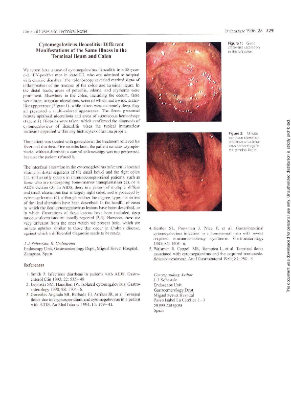 (PDF) Cytomegalovirus Ileocolitis: Different Manifestations of the Same ...
