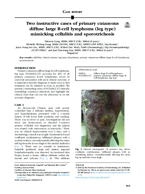 (PDF) Two instructive cases of primary cutaneous diffuse large B-cell lymphoma (leg type ...