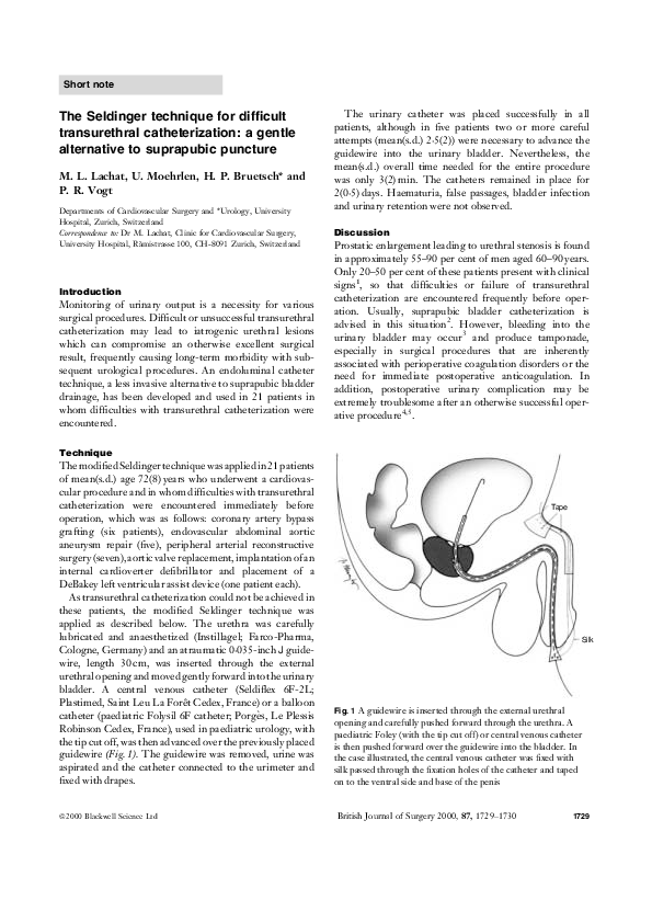 (PDF) The Seldinger technique for difficult transurethral ...