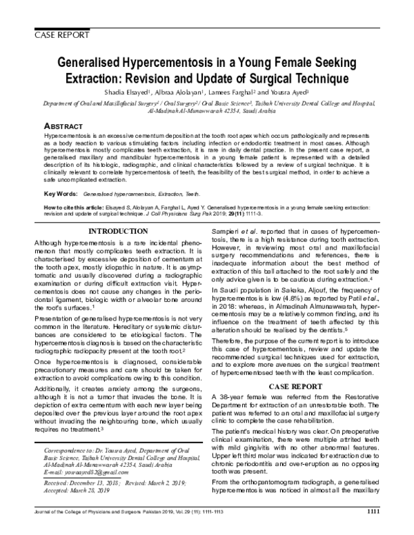 (PDF) Generalised Hypercementosis in a Young Female Seeking Extraction ...
