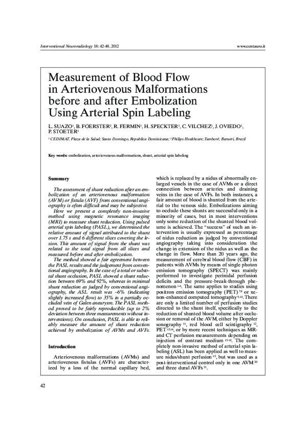(PDF) Measurement of Blood Flow in Arteriovenous Malformations before ...