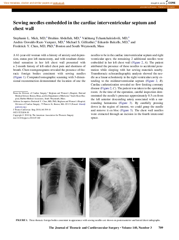 (PDF) Sewing needles embedded in the cardiac interventricular septum ...