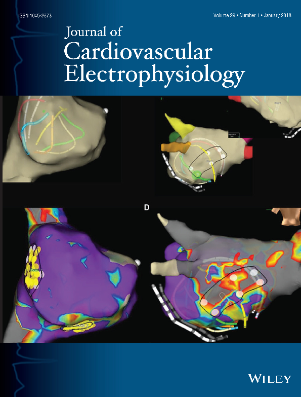 (PDF) Intracardiac ablation for atrioventricular nodal reentry ...