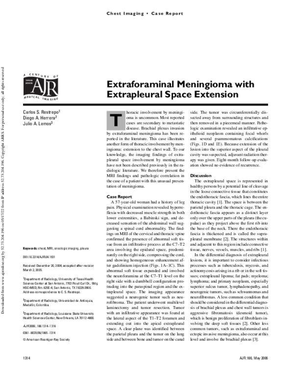 (PDF) Extraforaminal Meningioma with Extrapleural Space Extension