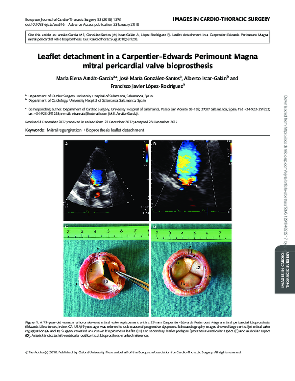 (PDF) Leaflet detachment in a Carpentier-Edwards Perimount Magna mitral ...