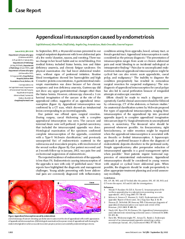 (PDF) Appendiceal intussusception caused by endometriosis