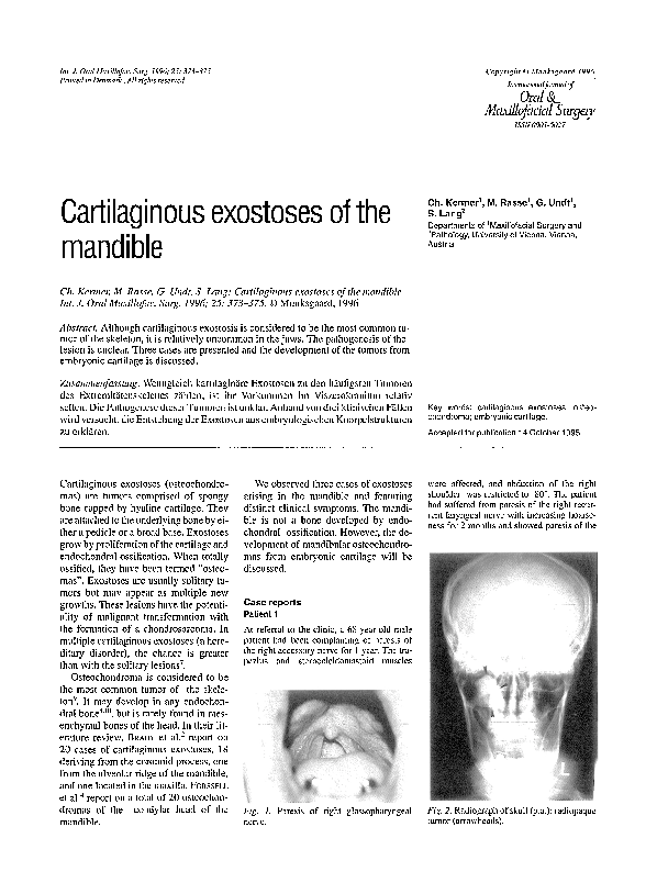 (PDF) Cartilaginous exostoses of the mandible