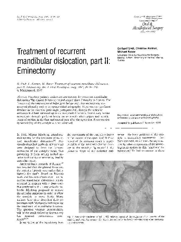 (PDF) Treatment of recurrent mandibular dislocation, part II: Eminectomy