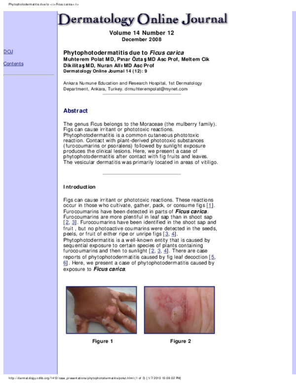 Pdf Phytophotodermatitis Due To Ficus Carica Nuran Alli