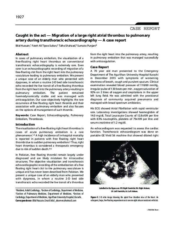 (PDF) Caught in the act - Migration of a large right atrial thrombus to ...