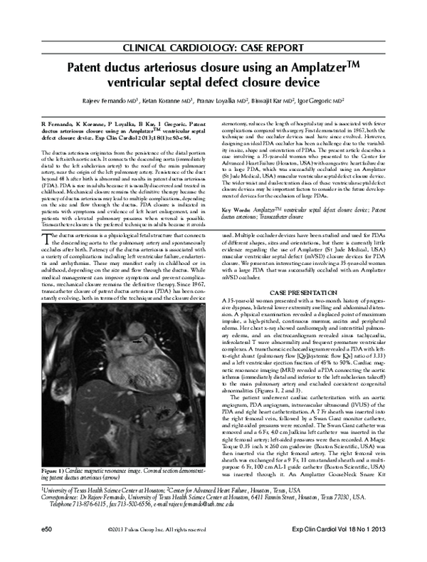 (PDF) Patent ductus arteriosus closure using an Amplatzer ...