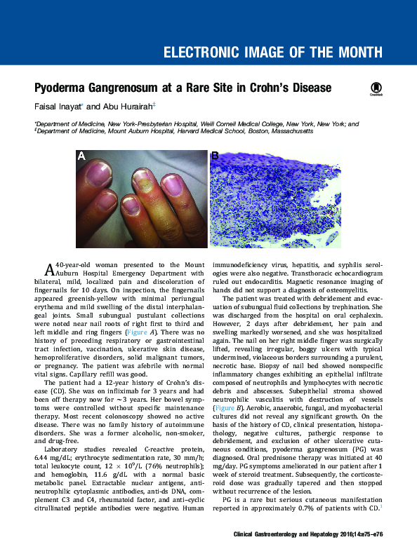 (PDF) Pyoderma gangrenosum at a rare site in Crohn’s disease | abu ...