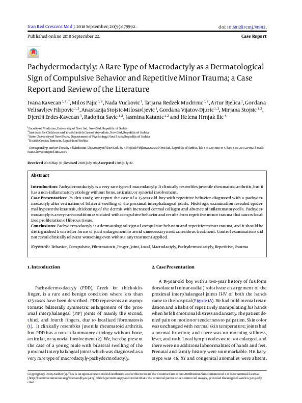 (PDF) Pachydermodactyly: A Rare Type of Macrodactyly as a ...