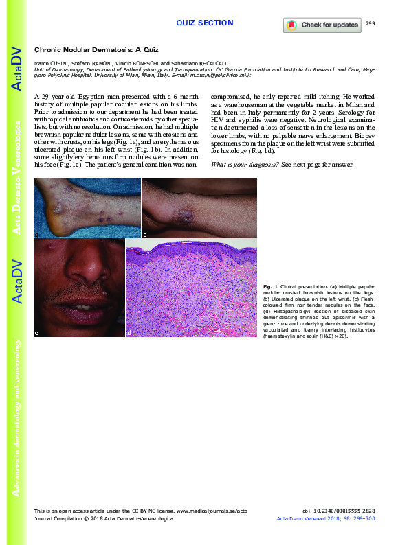 (PDF) Chronic Nodular Dermatosis: A Quiz