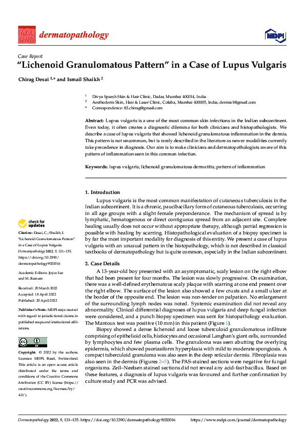 (PDF) “Lichenoid Granulomatous Pattern” in a Case of Lupus Vulgaris
