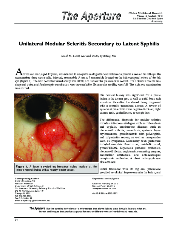 (PDF) Nodular Scleritis from Latent Syphilis