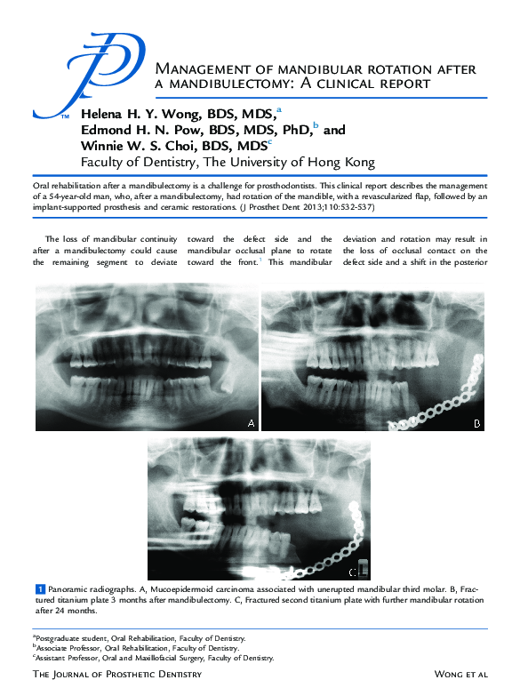 (PDF) Management of mandibular rotation after a mandibulectomy: A ...