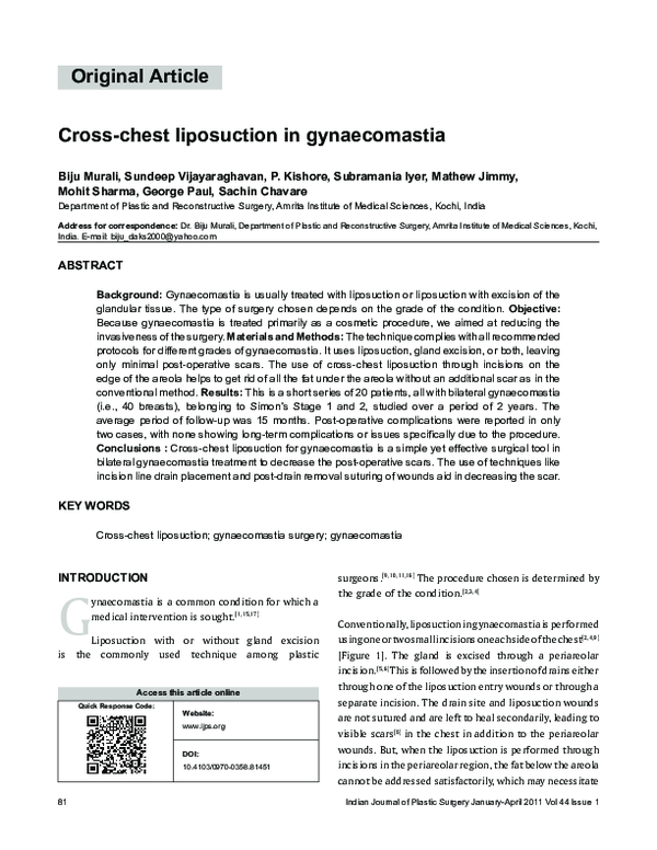 (PDF) Cross-chest liposuction in gynaecomastia