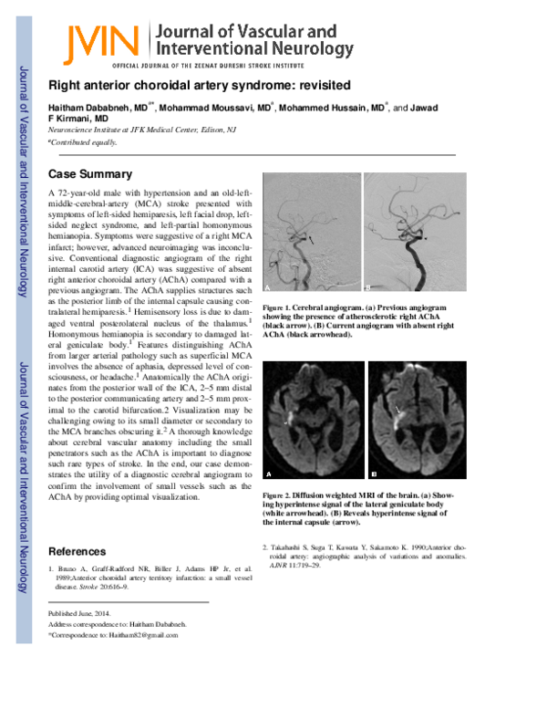 Pdf Right Anterior Choroidal Artery Syndrome Revisited