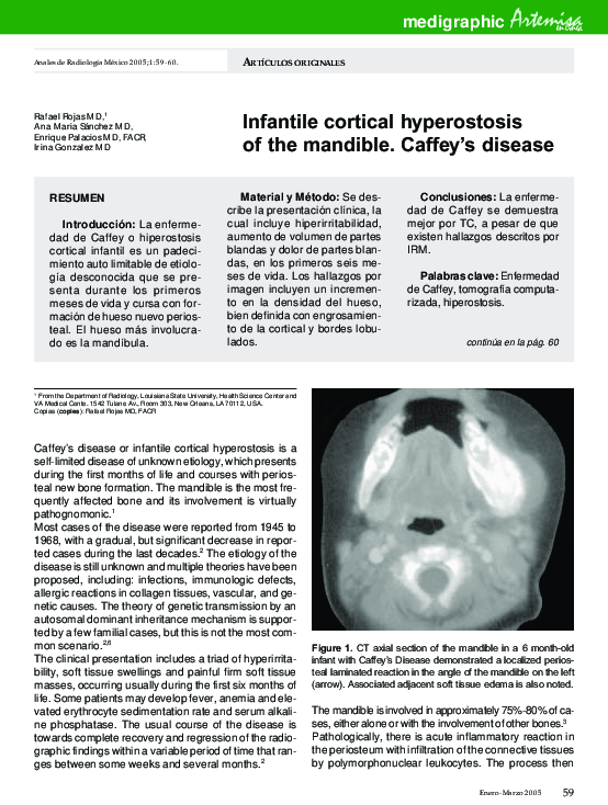 (PDF) Infantile cortical hyperostosis of the mandible. Caffey's disease