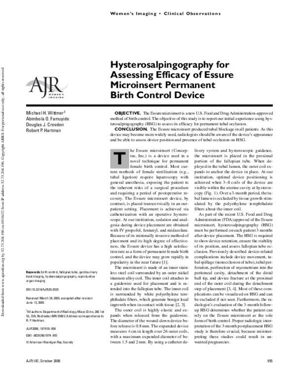 (PDF) Hysterosalpingography for Assessing Efficacy of Essure ...